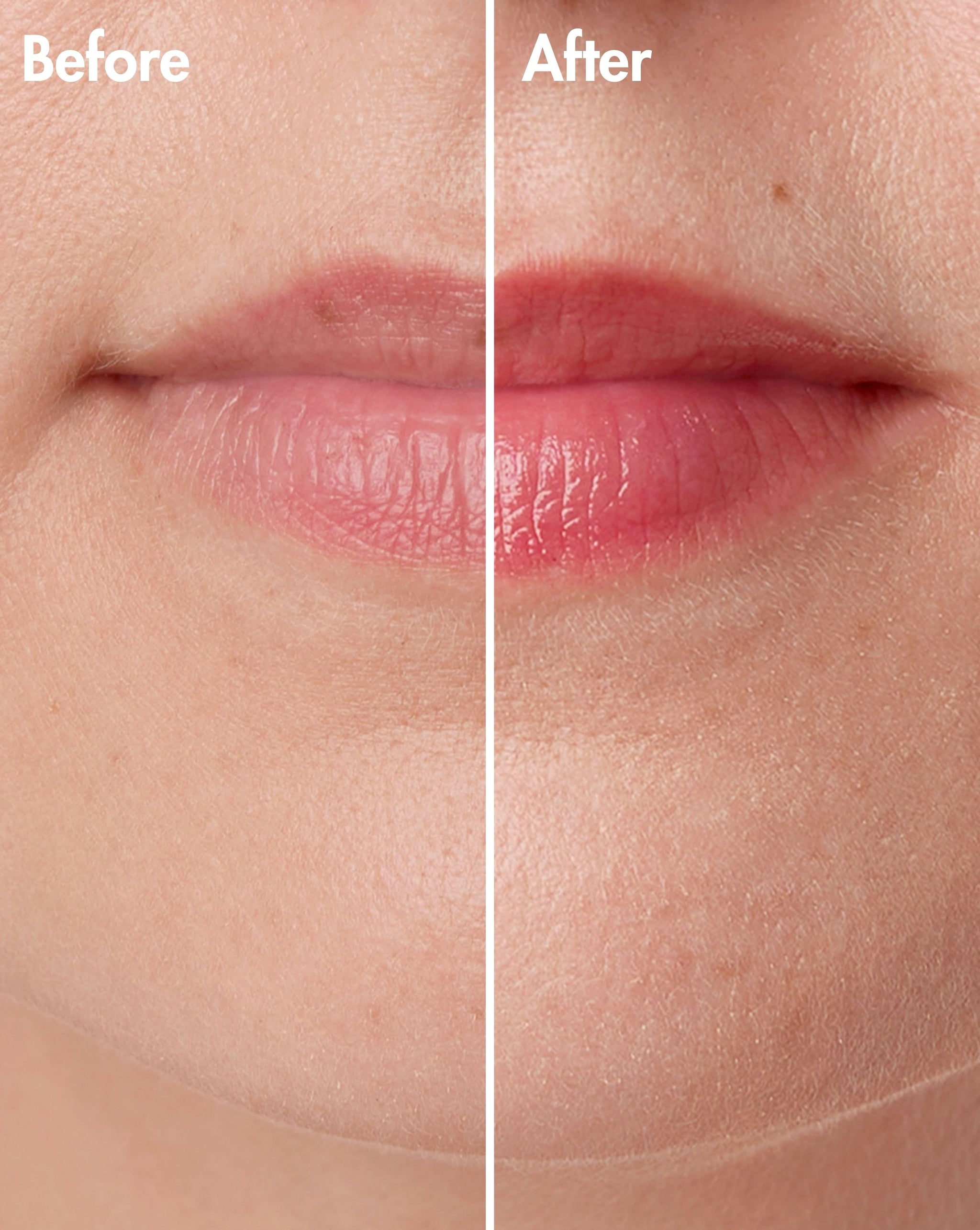 Lip Repair Natural Pink | Lip Balm | Skinome